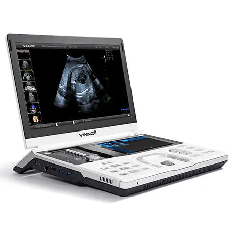 Portable Ultrasound Machines | Point-of-Care Imaging | SelfiMed UK